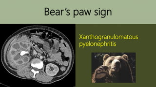 Genitourinary signs.pptx