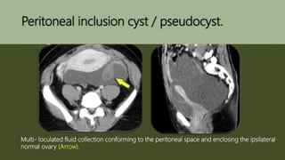 Genitourinary signs.pptx