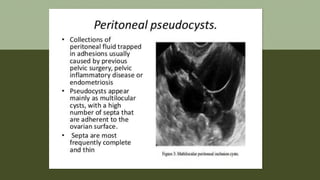 Genitourinary signs.pptx