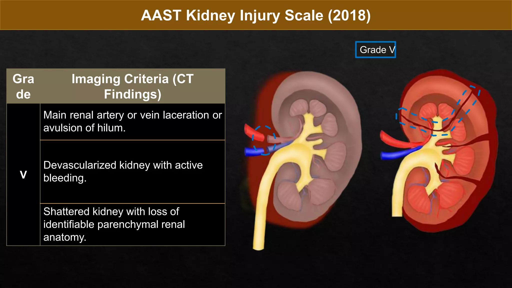 Genitourinary trauma.pptx