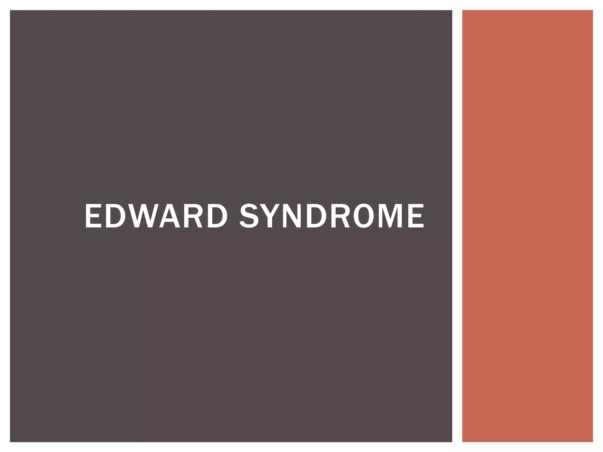 Edward syndrome | PPTX