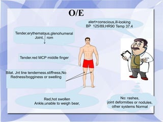 reactive arthritis | PPTX | Diseases and Conditions | Medical Health