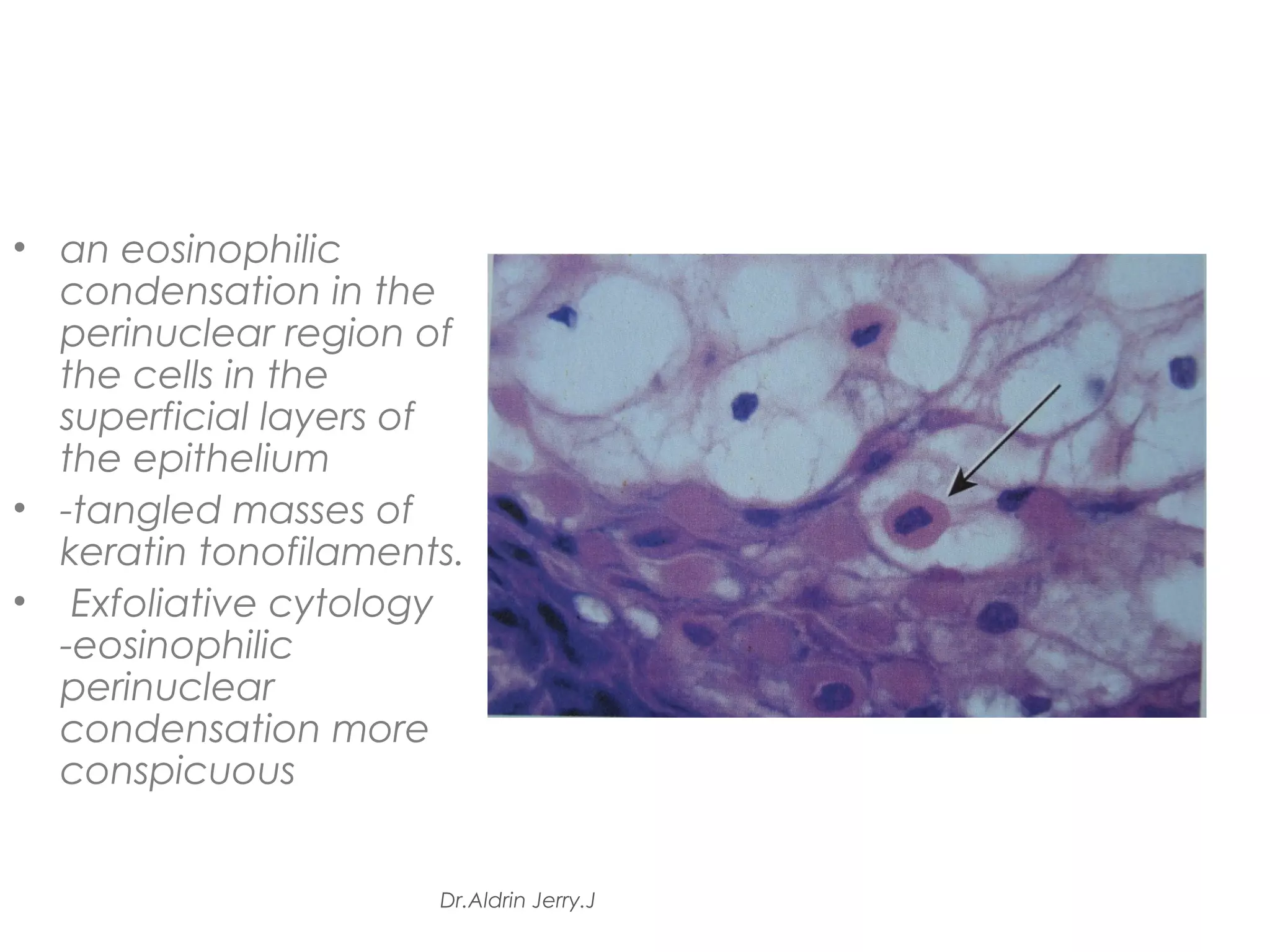 Genodermatoses - Oral Pathology | PPT