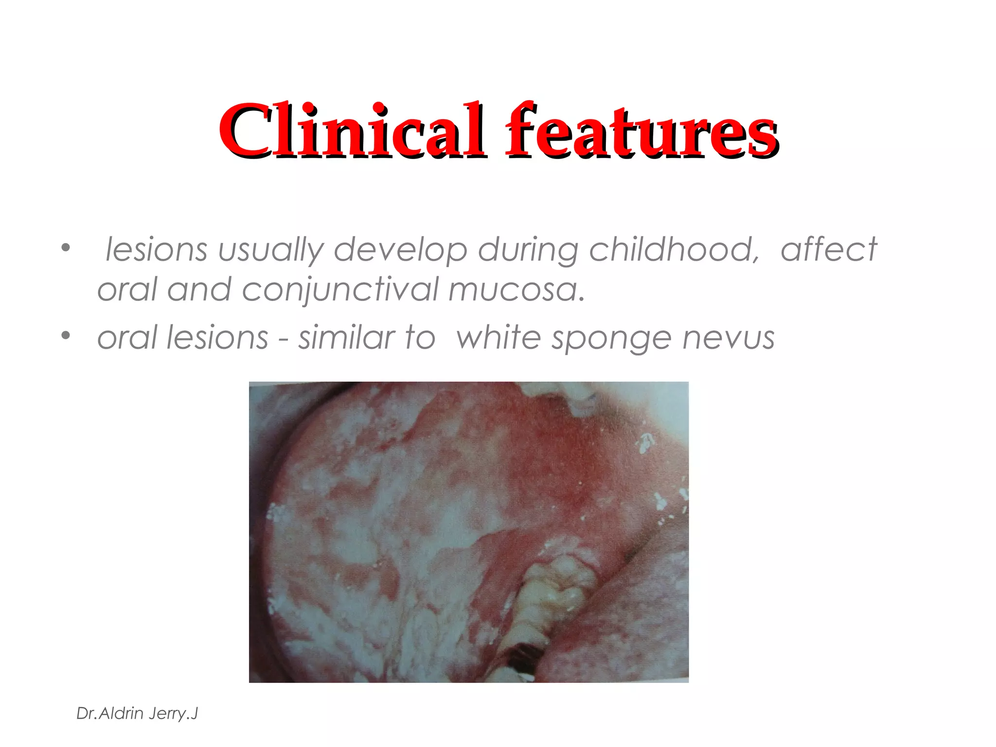 Genodermatoses - Oral Pathology | PPT