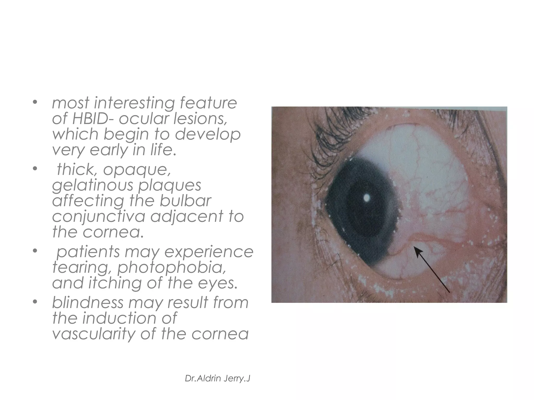 Genodermatoses - Oral Pathology | PPT