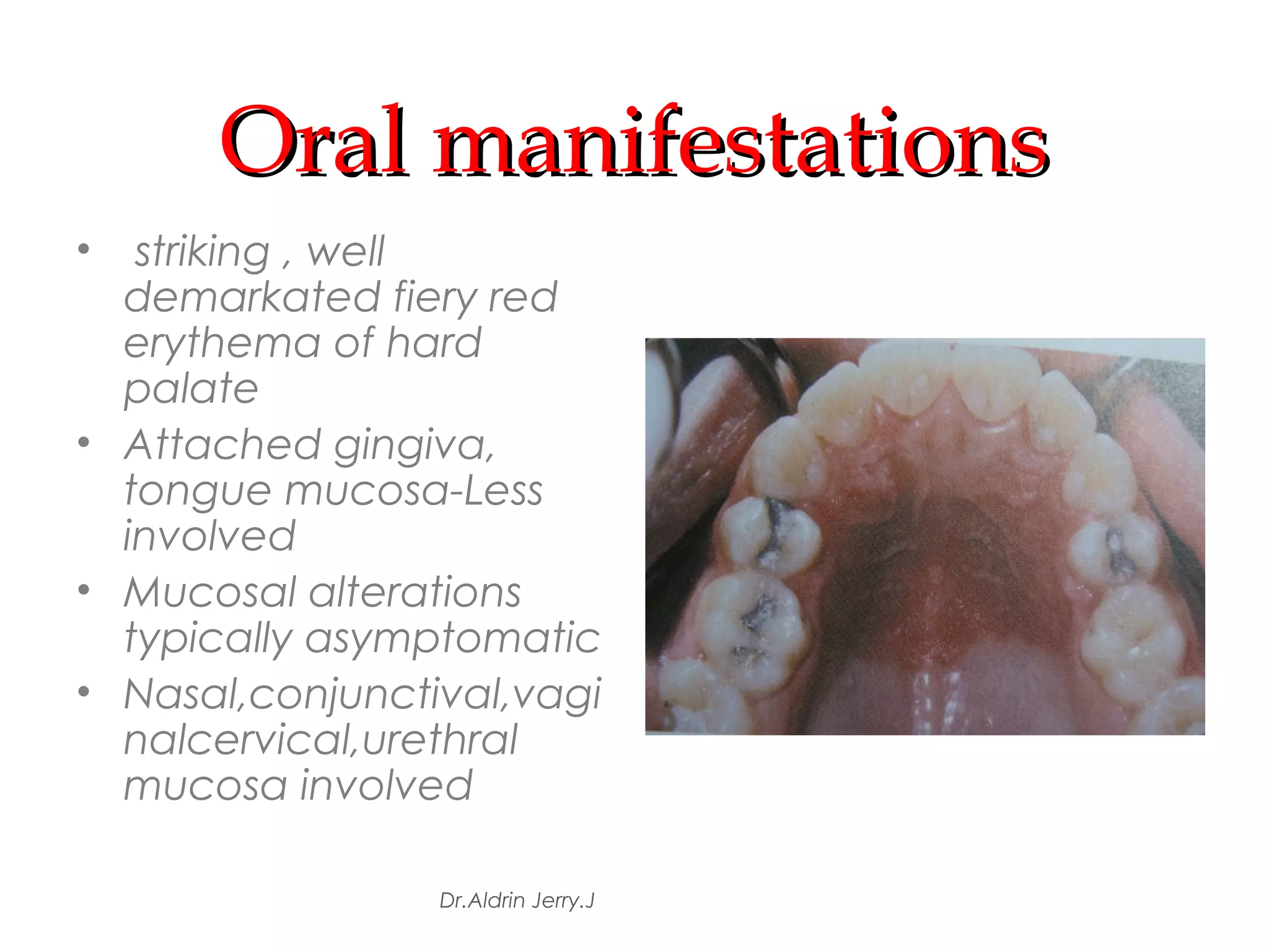 Genodermatoses - Oral Pathology | PPT