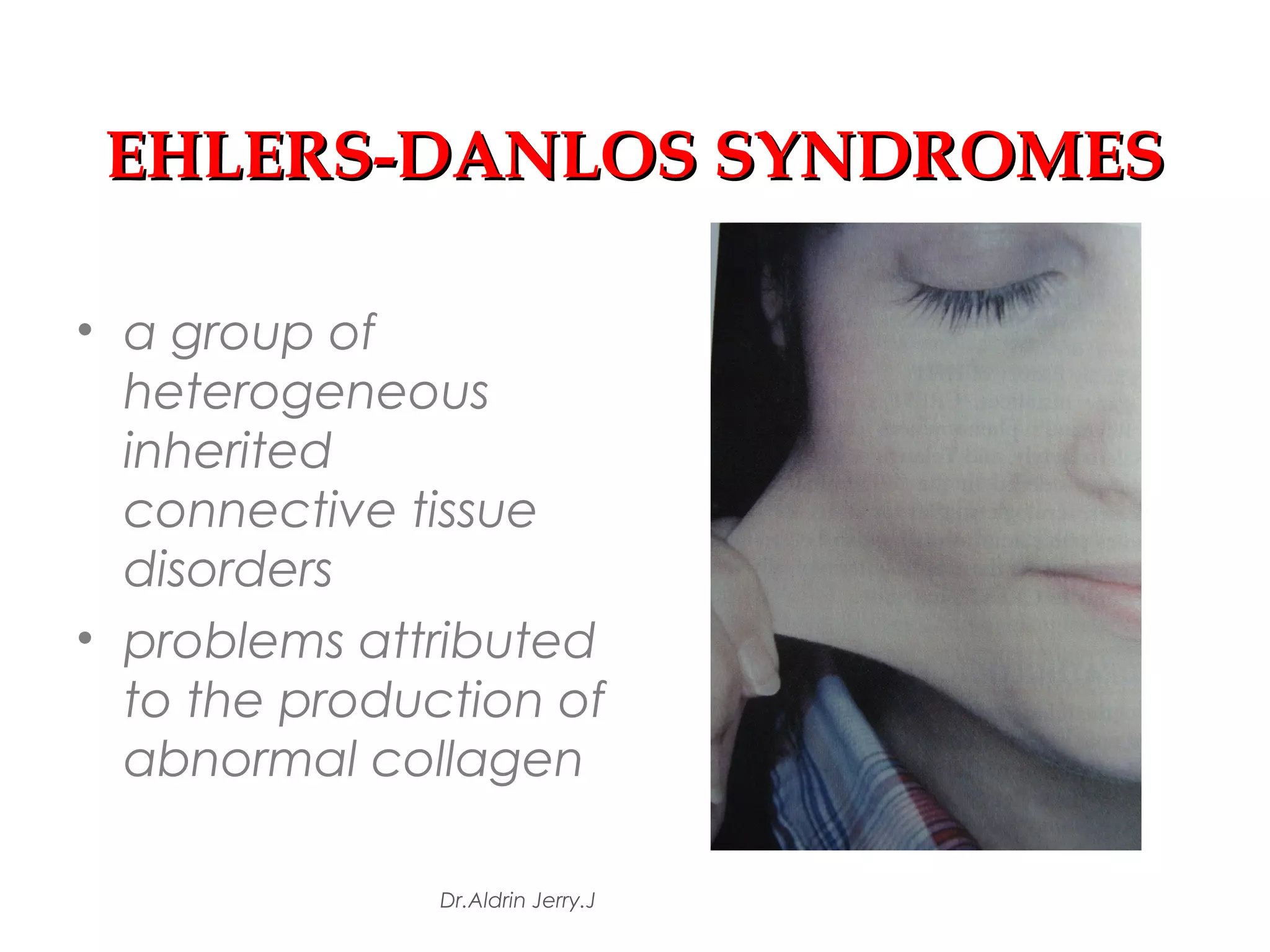 Genodermatoses - Oral Pathology | PPT