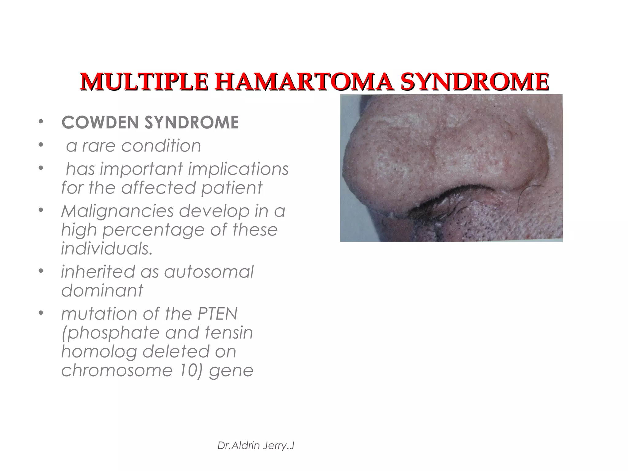 Genodermatoses - Oral Pathology | PPT