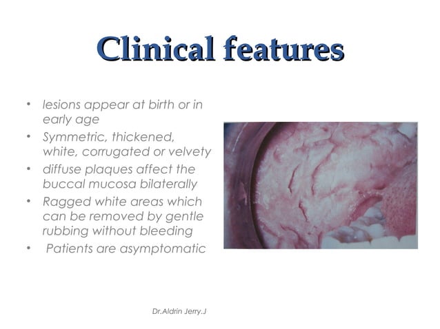 Genodermatoses - Oral Pathology | PPT | Skin and Dermatology | Diseases ...