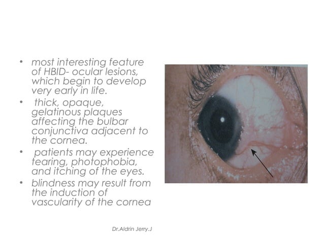 Genodermatoses - Oral Pathology | PPT | Skin and Dermatology | Diseases ...