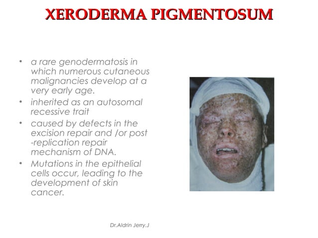Genodermatoses - Oral Pathology | PPT | Skin and Dermatology | Diseases ...