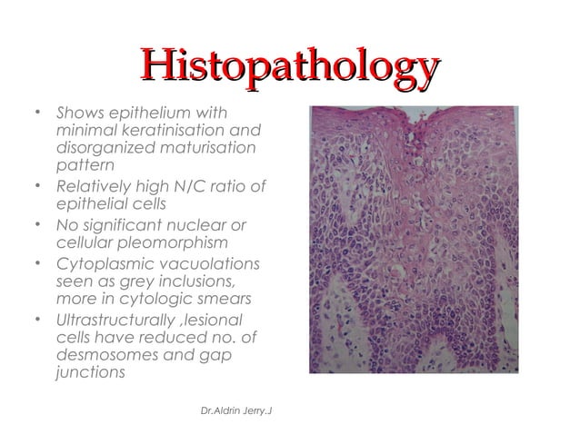 Genodermatoses - Oral Pathology | PPT | Skin and Dermatology | Diseases ...