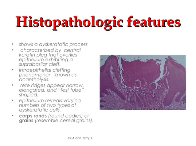 Genodermatoses - Oral Pathology | PPT | Skin and Dermatology | Diseases ...