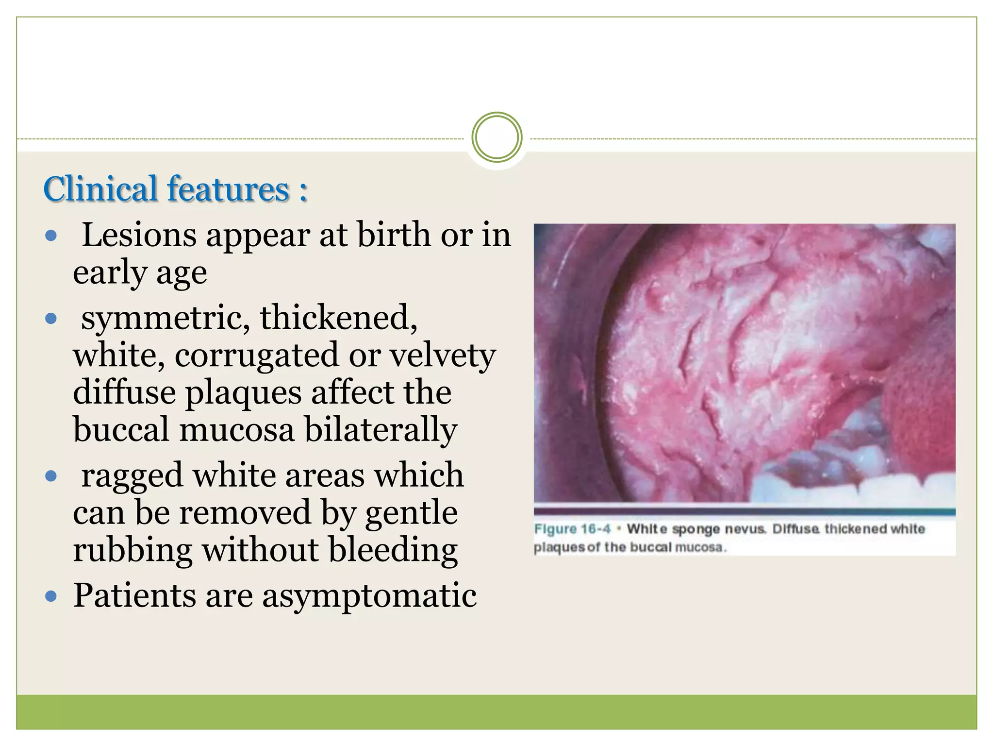Genodermatoses | PPTX