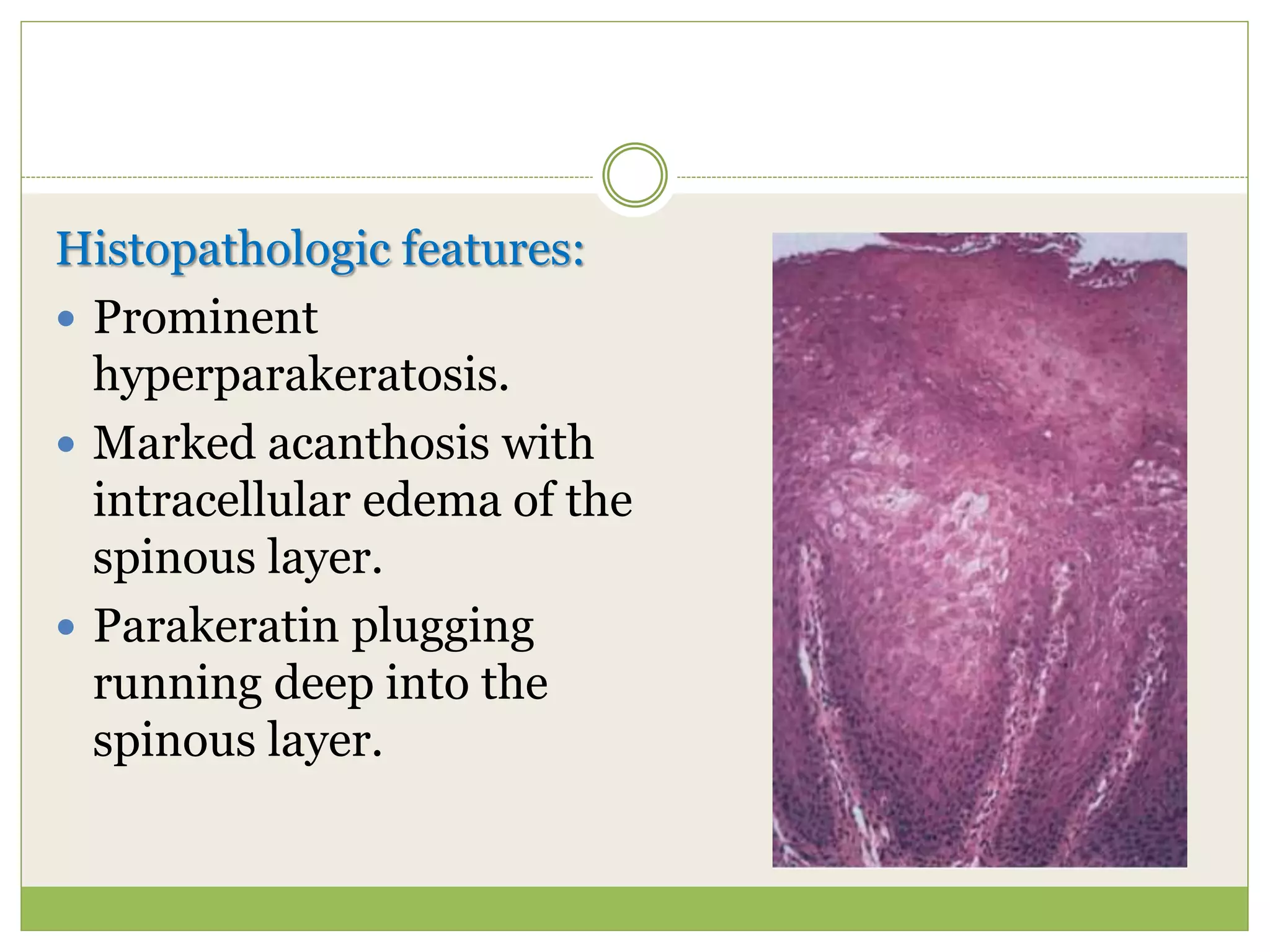 Genodermatoses | PPTX