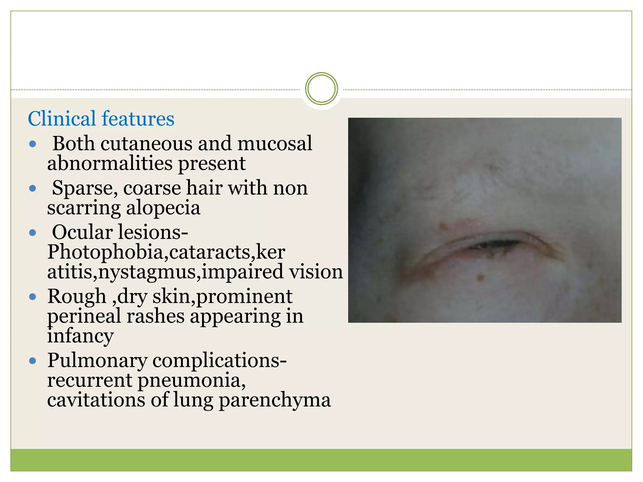 Genodermatoses | PPTX