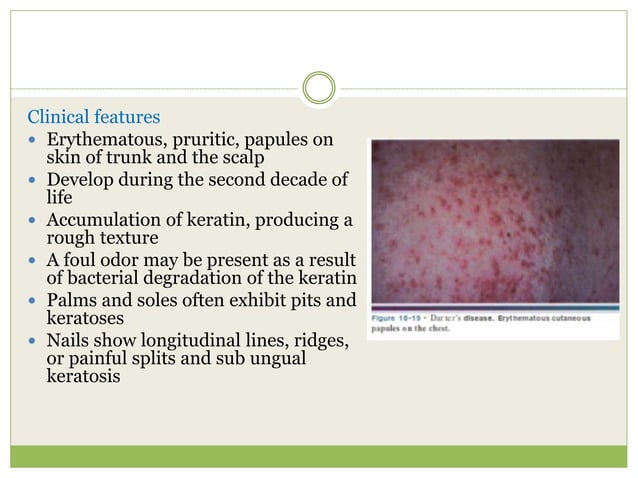 Genodermatoses | PPTX | Skin and Dermatology | Diseases and Conditions