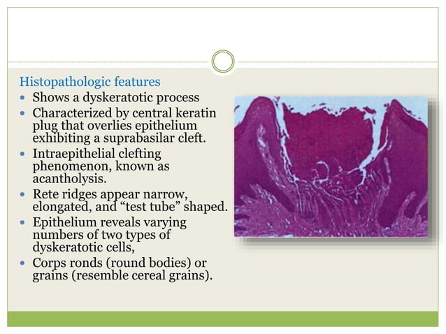 Genodermatoses | PPTX | Skin and Dermatology | Diseases and Conditions