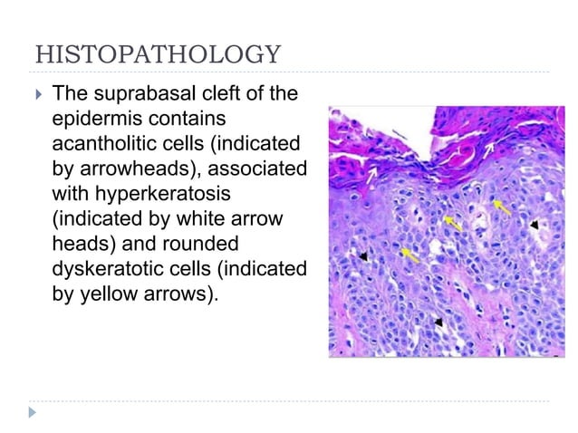 Genodermatoses.pptx | Skin and Dermatology | Diseases and Conditions