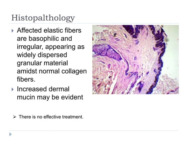 Genodermatoses.pptx | Skin and Dermatology | Diseases and Conditions