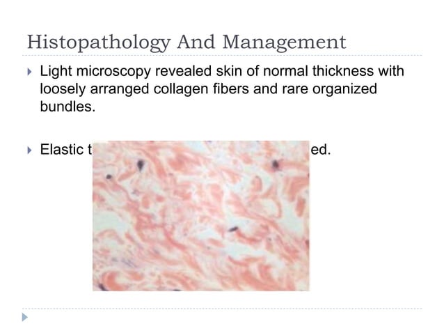 Genodermatoses.pptx | Skin and Dermatology | Diseases and Conditions