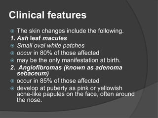 Genodermatosis | PPTX