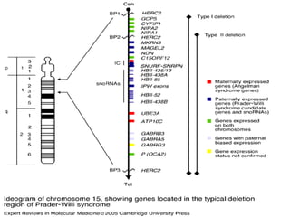 Genotype Phenotype Correlation In Prader Willi Syndrome | PPT