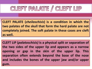 Cleft Palate | PPTX | Pregnancy | Reproductive Health