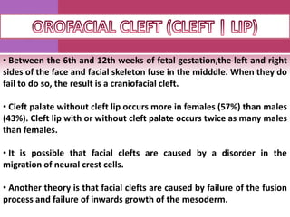Cleft Palate | PPTX
