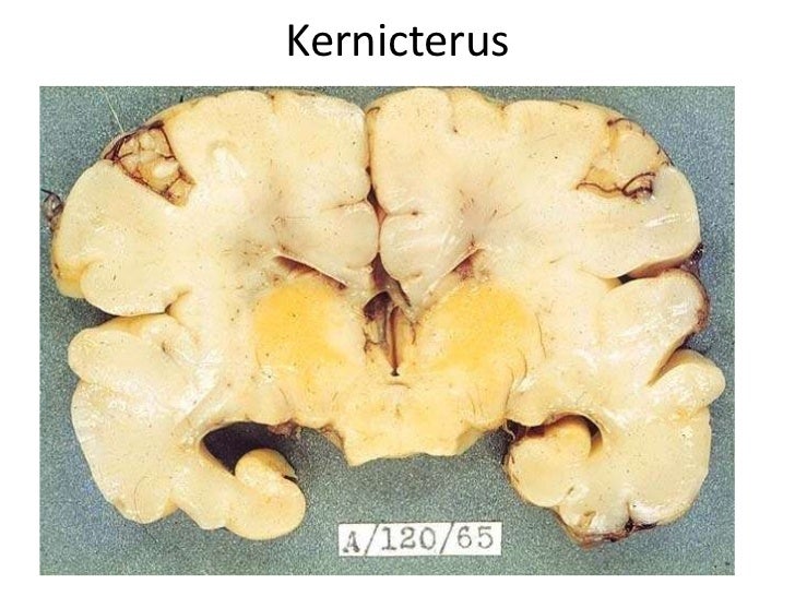 Gen pathology finals pictures