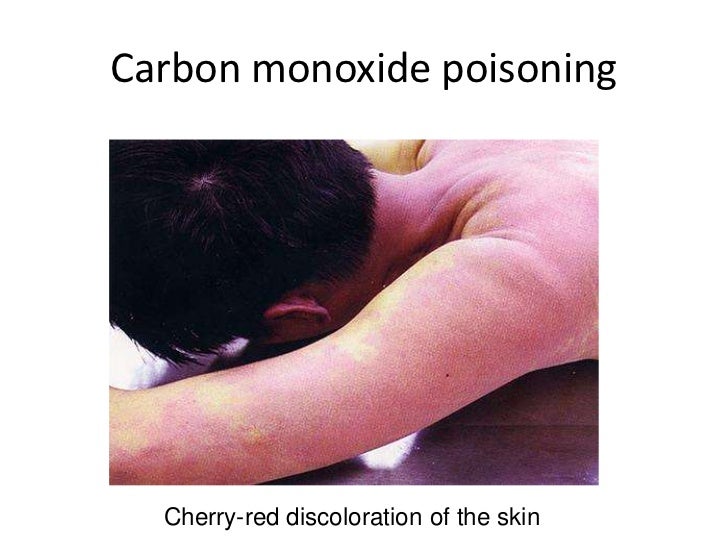 Gen pathology finals pictures