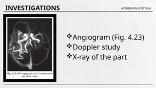 ARTERIOVENOUS FISTULA GENERAL SURGERY BY AKASH SURESH.pptx