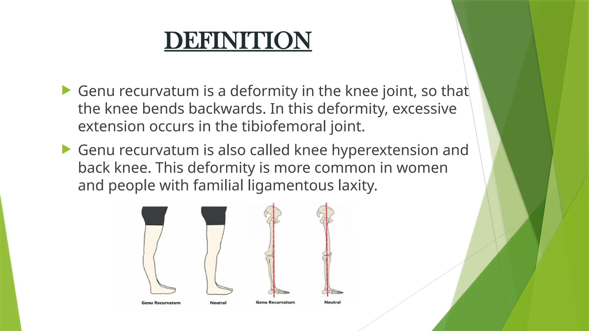 GENU-RECURVATUM deformity of the knee joint | PPT