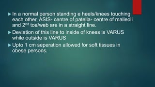 Genu Valgum.pptx