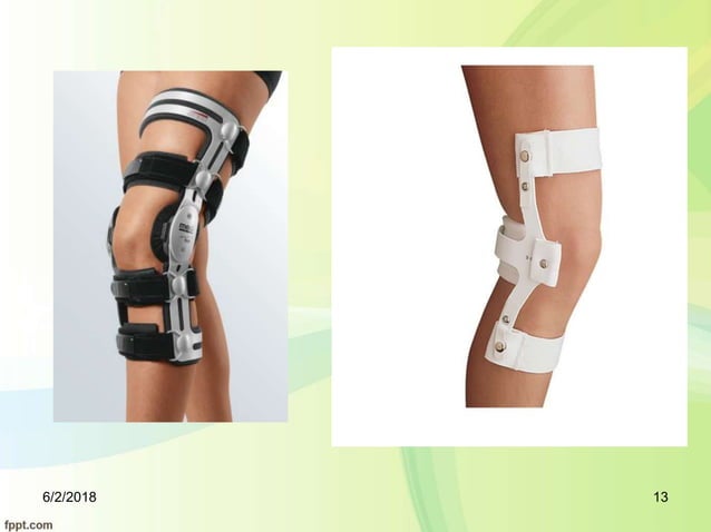 Genu recurvatum | PPTX