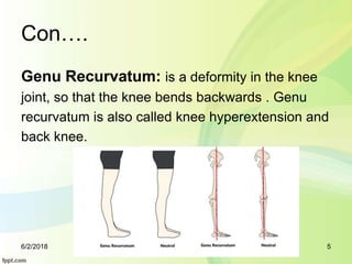 Genu recurvatum | PPTX