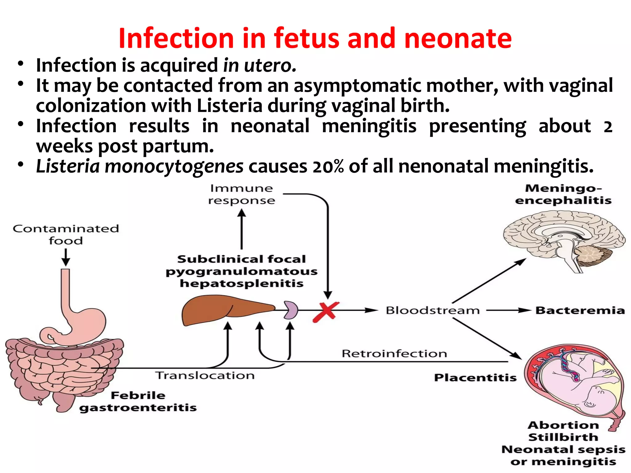 Genus listeria | PPT