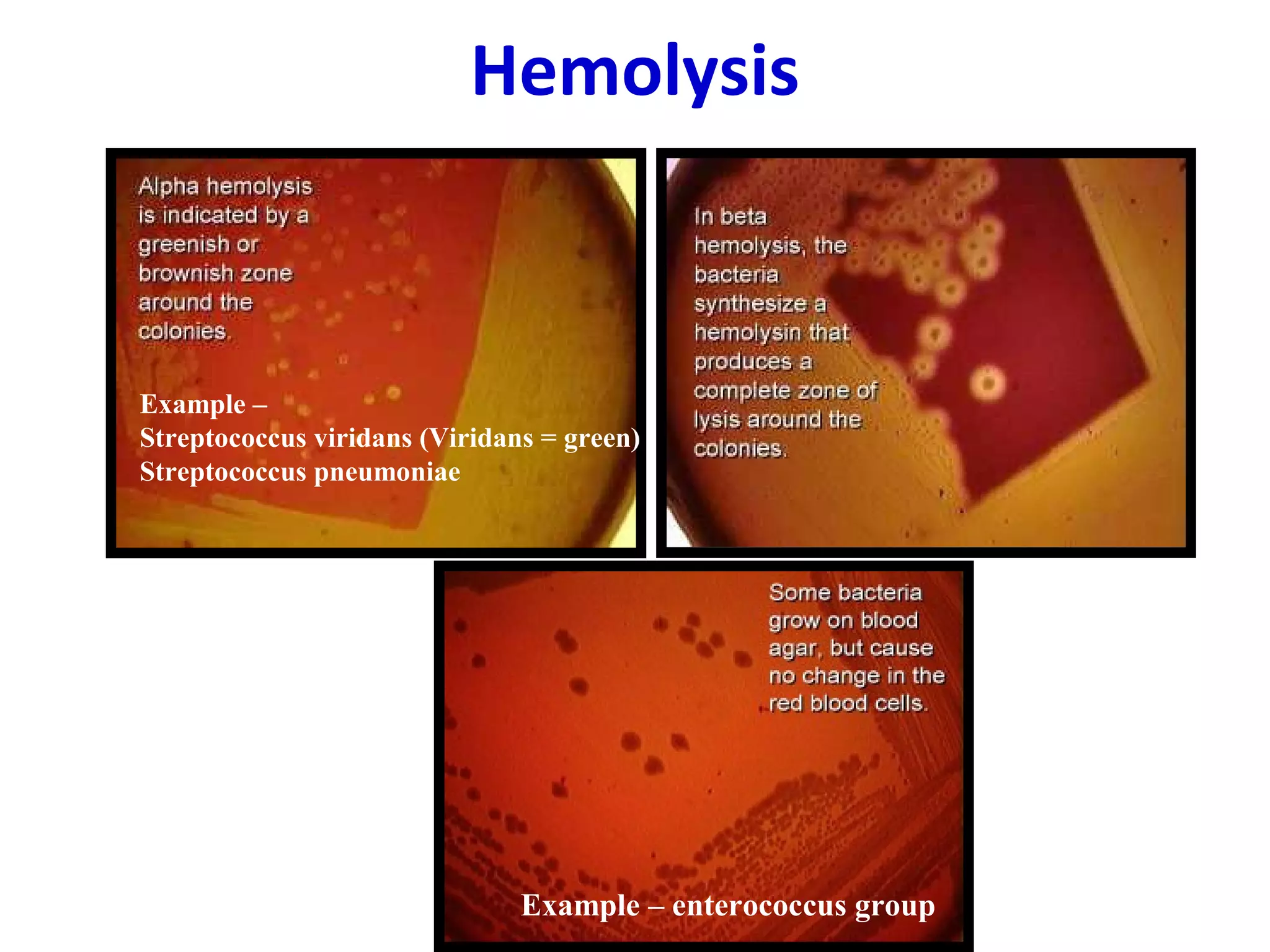 Genus Streptococcus | PPT