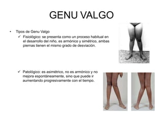 GENU VALGO.pptx