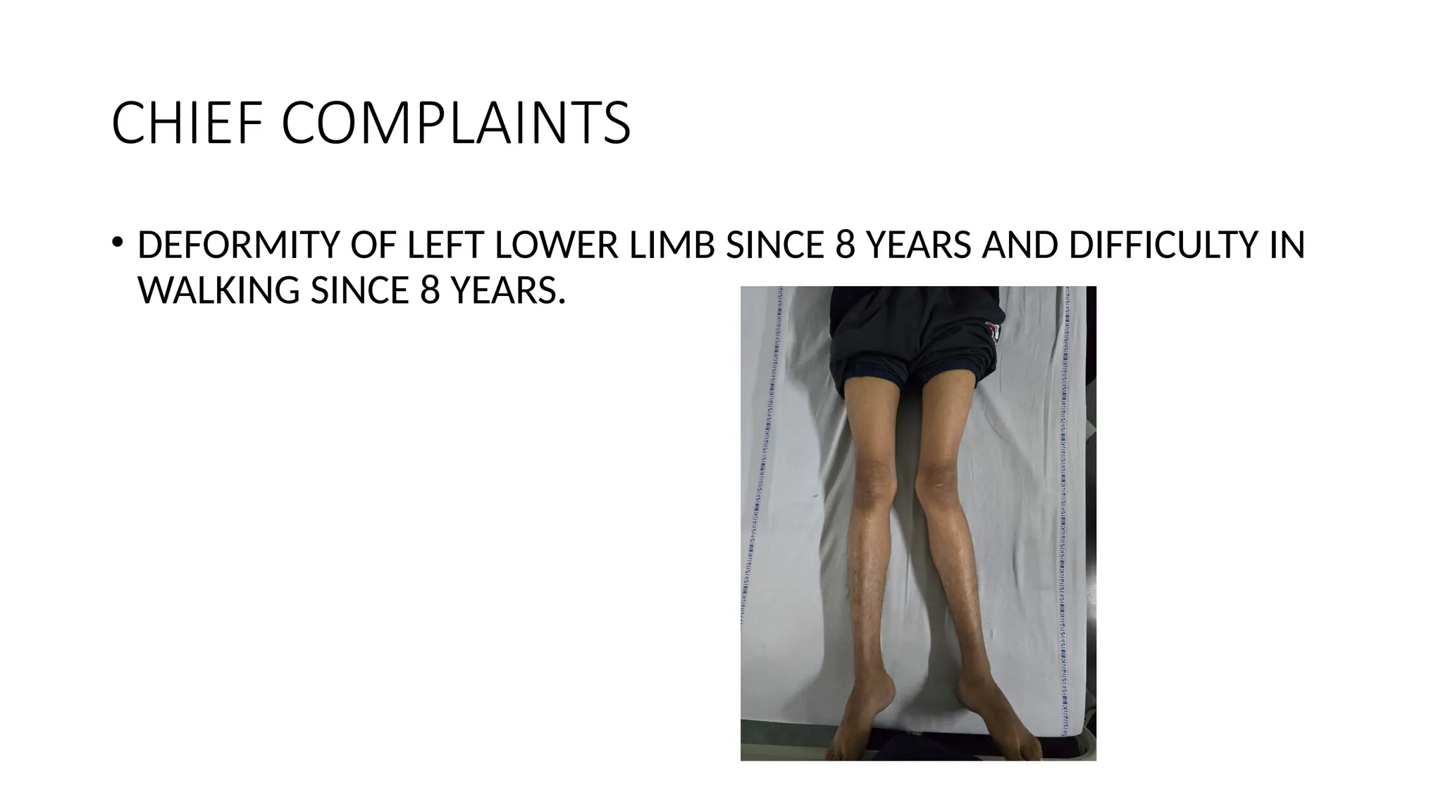 GENU VALGUM knee deformity clinical case | PPTX