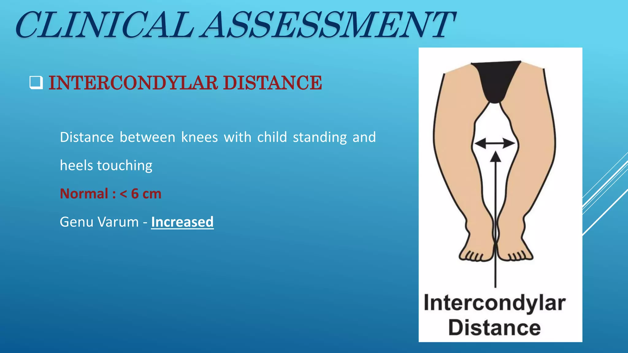 GENU VALGUM & VARUM.pptx