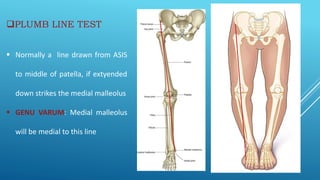 GENU VALGUM & VARUM.pptx