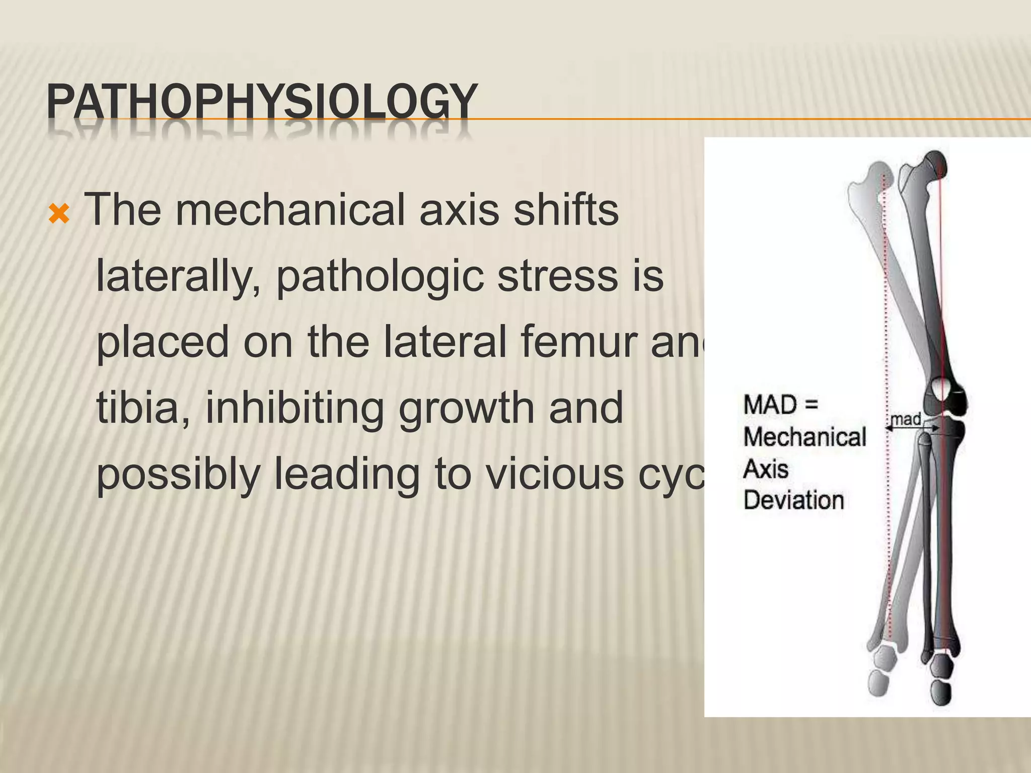 Genu valgus | PPTX