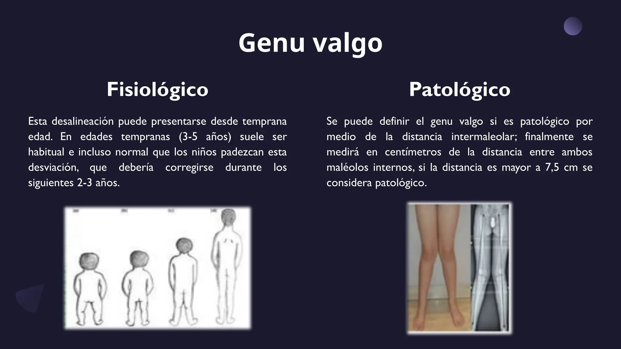 Genu varo y Genu valgo Caracteristicas.pptx