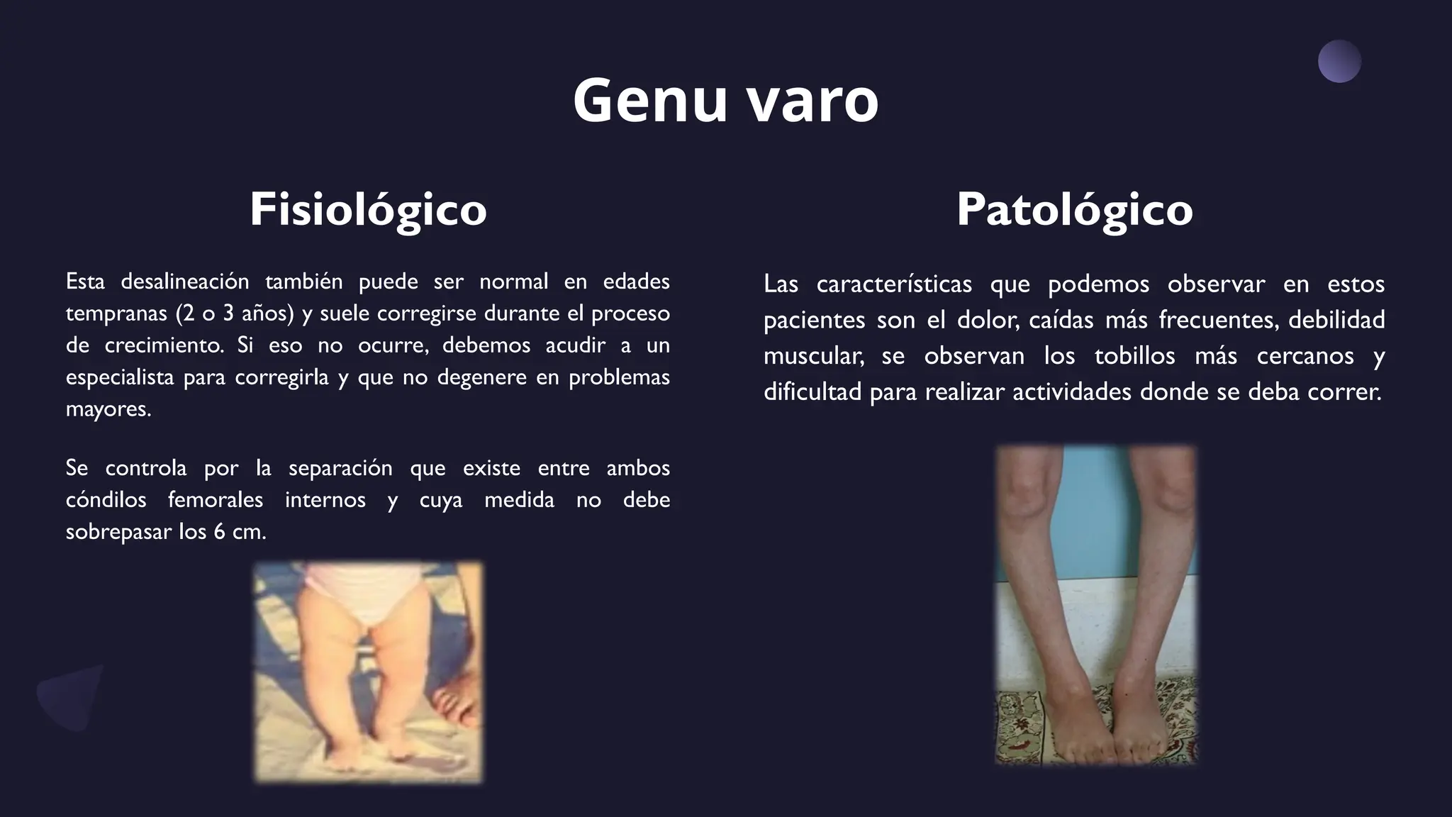 Genu varo y Genu valgo Caracteristicas.pptx