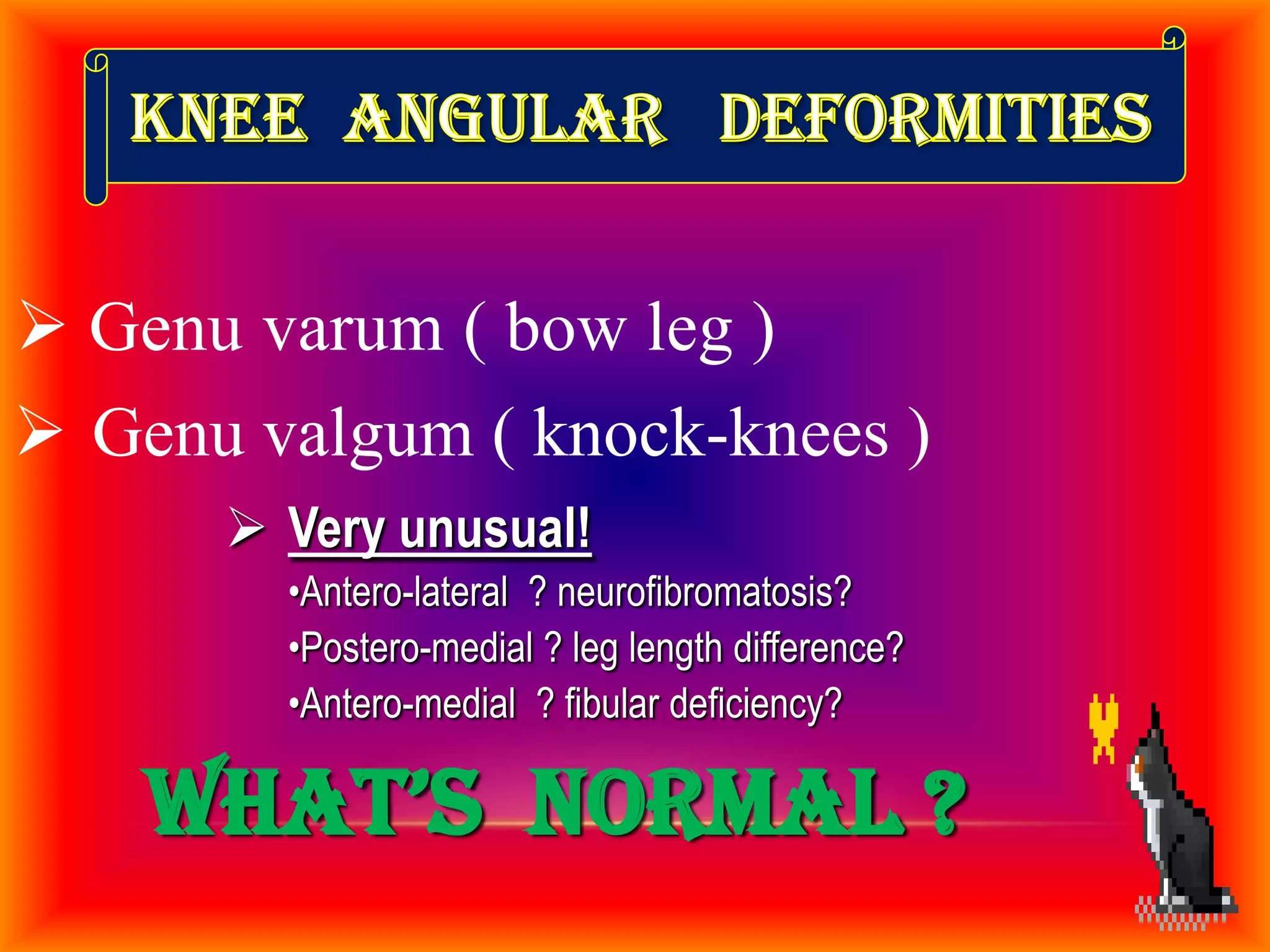 Genu varum | PPTX