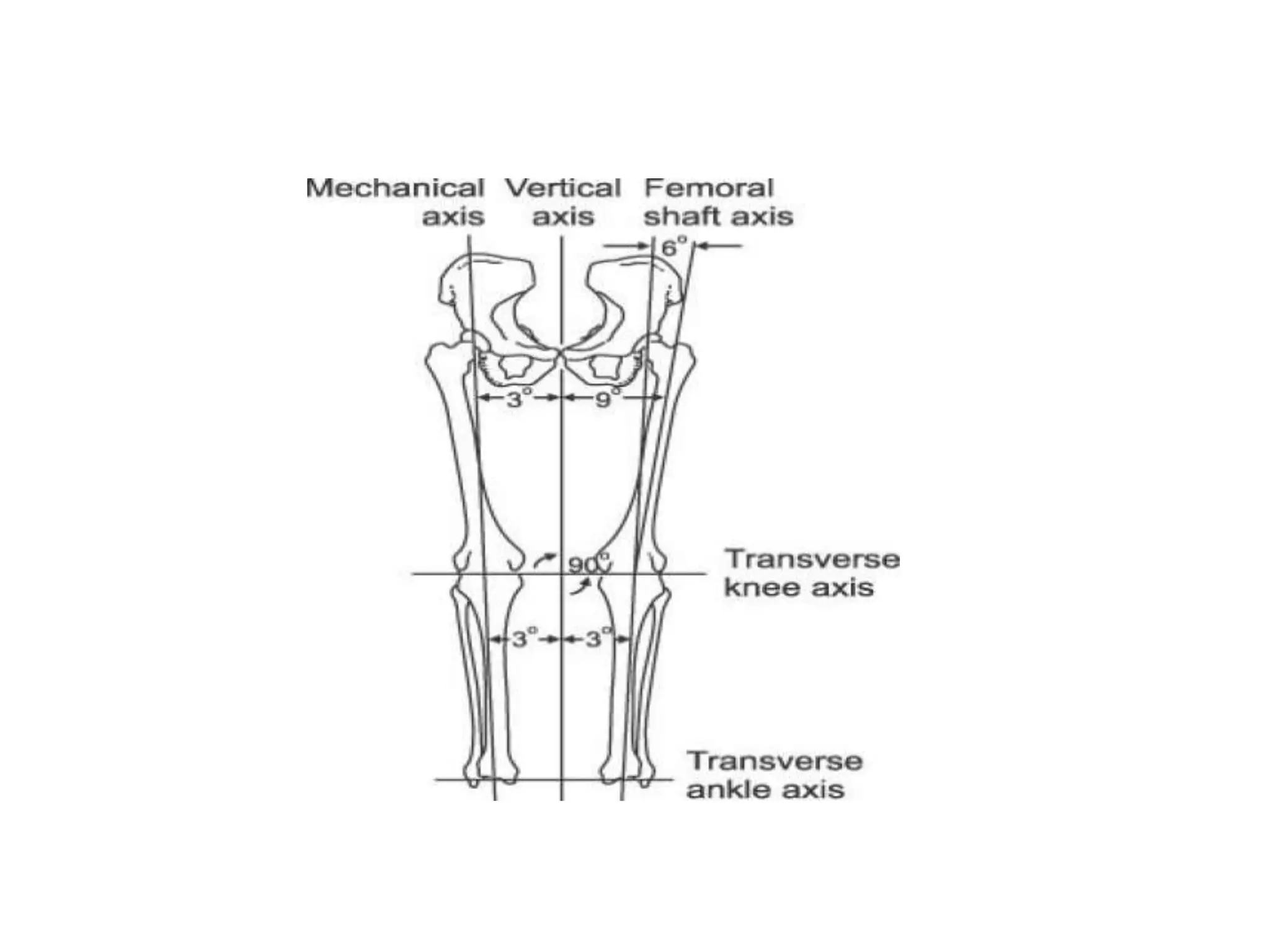 Genu varum, Genu valgum, Genu recurvatum | PPTX