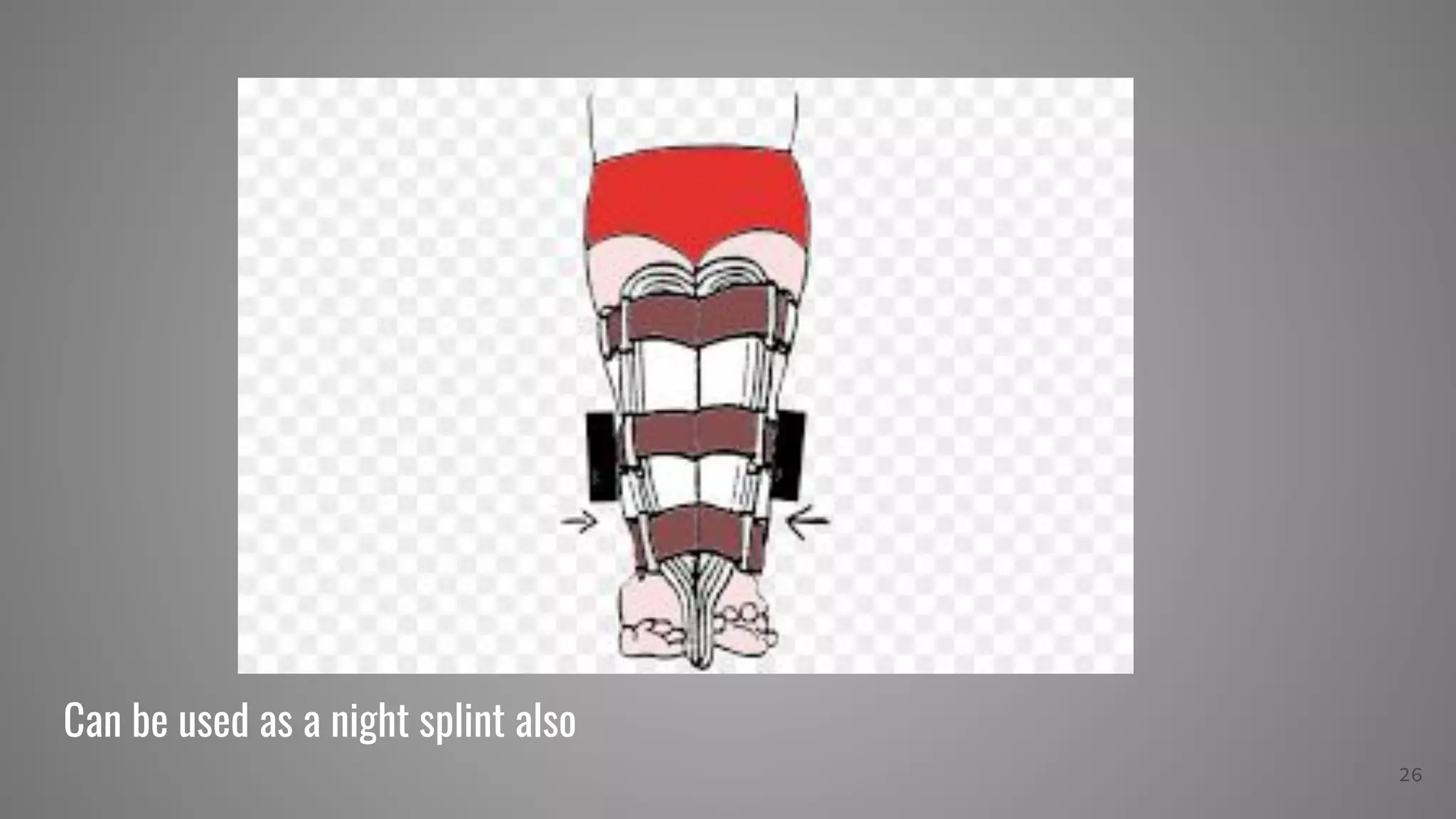 Genu varum orthotic management | PDF