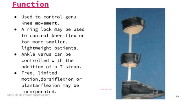 Genu varum orthotic management | PDF