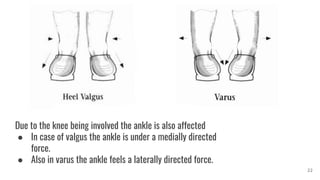 Genu varum orthotic management | PDF